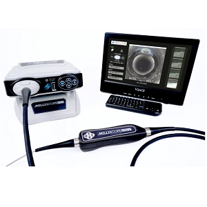Milliscope HDV - Zibra Corporation | Borescope
